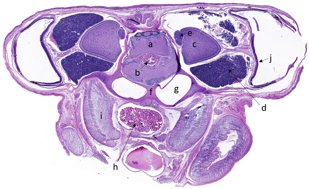 Octopus Brain Esophagus